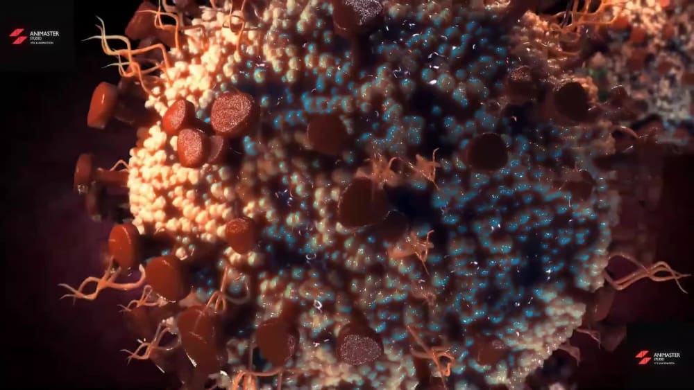 A professional 3D Medical and surgical Animation | Upwork