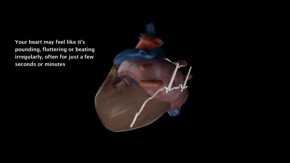 3D medical animation, surgery animation video 2d medical animation ...