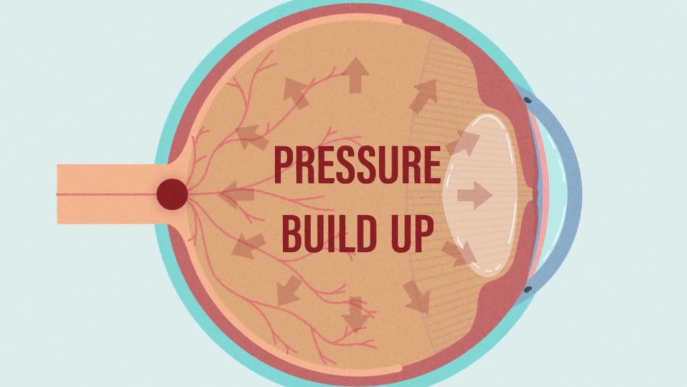 Animated designs and motion graphics in live-action footage video | Upwork