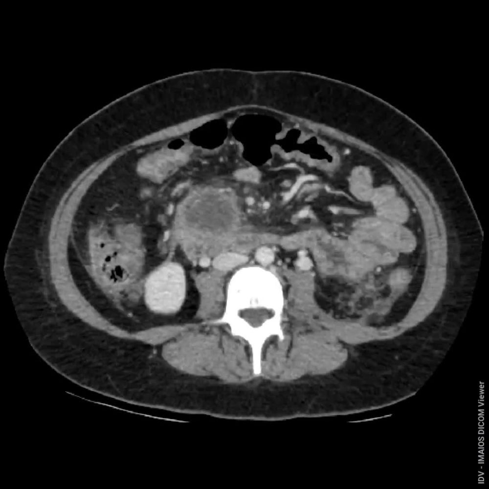 Professional mri and ct scan report analysis, pet scan report | Upwork