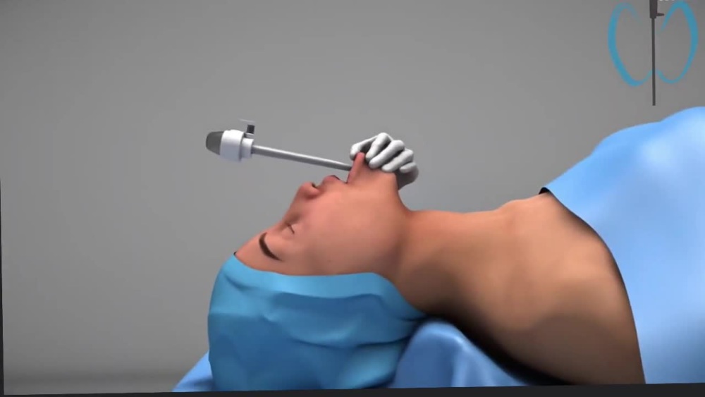 An Engaging 3D Dental Animation for Educational Purposes | Upwork
