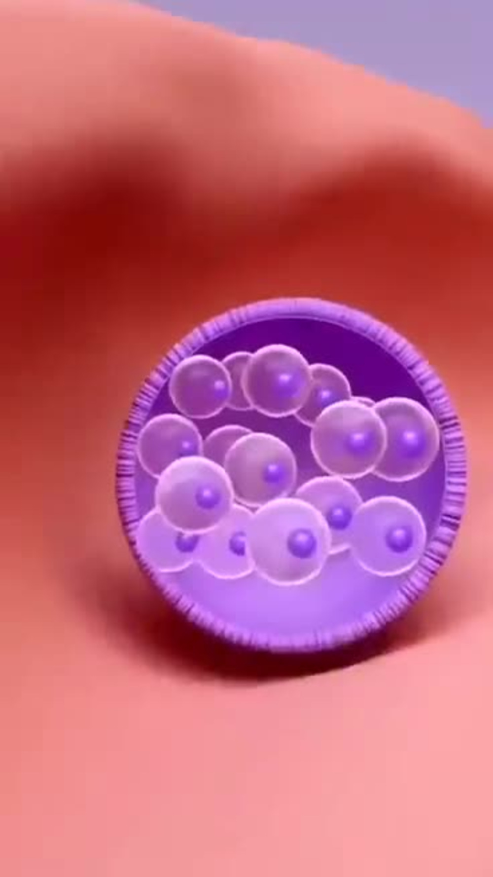 3d medical animation, surgery animation, anatomy animation | Upwork