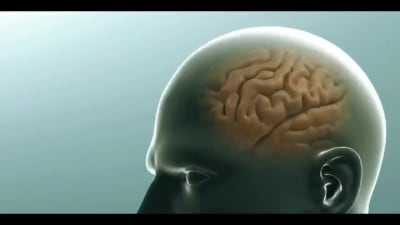 "Understanding Brain Cancer: Causes, Symptoms, and Treatment Strategies ...