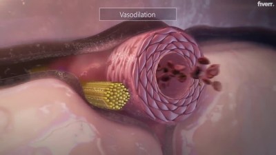3d medical animation video medical animation surgery 3d medical | Upwork