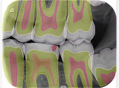 A highly precise dental annotation on 2-D, 3-D | Upwork