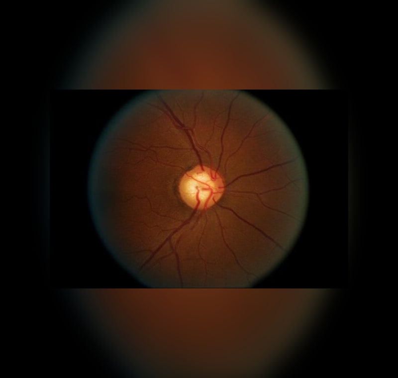 Eye care services (Ophthalmology): eye imaging | Treatments | Patients ...
