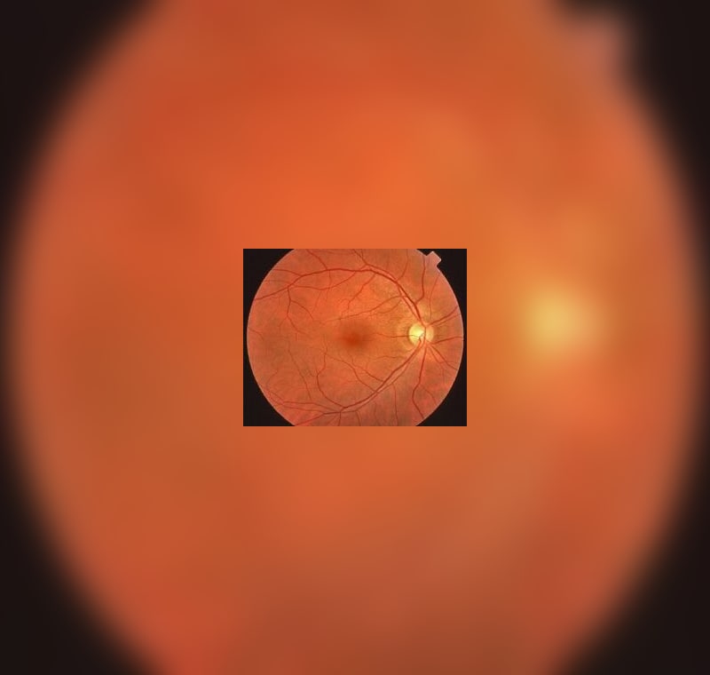 Eye care services (Ophthalmology): eye imaging | Treatments | Patients ...