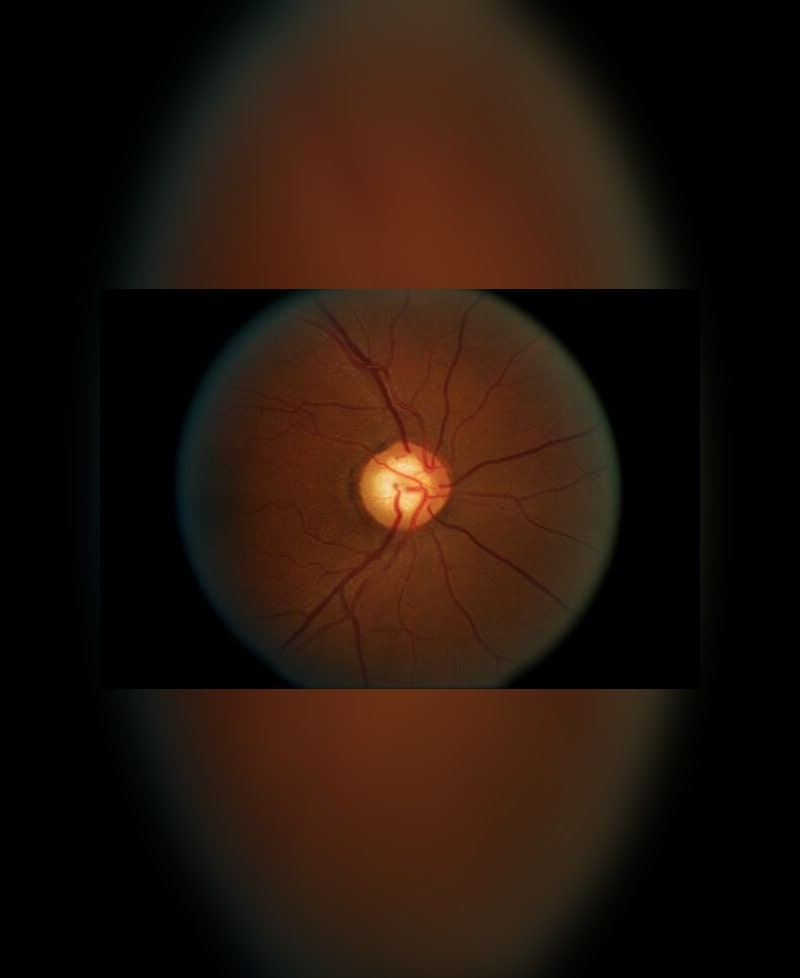 Eye care services (Ophthalmology): eye imaging | Treatments | Patients ...