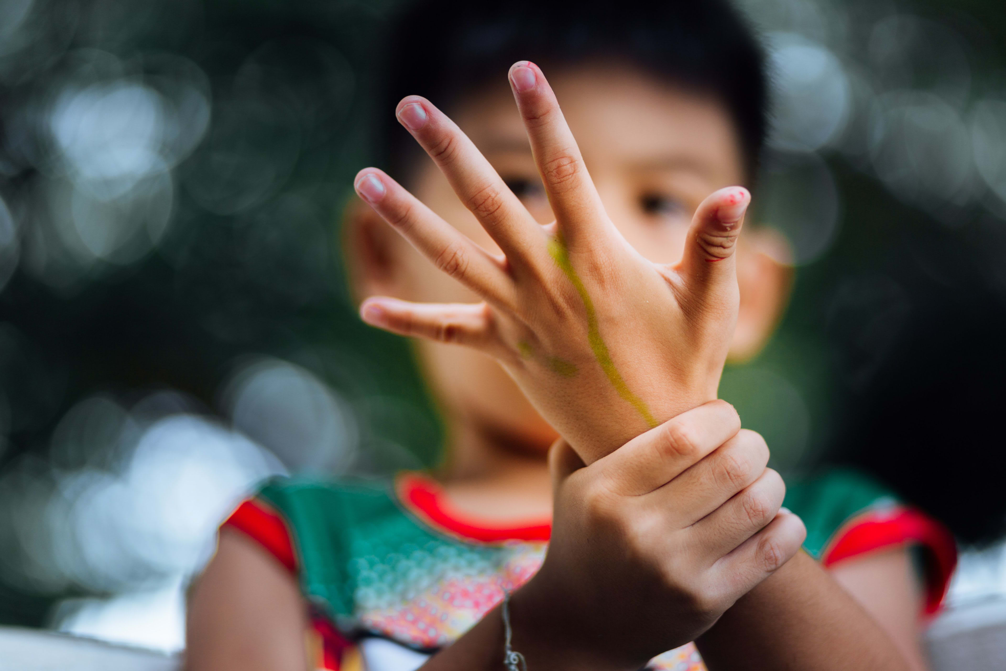 Pediatric rheumatology, diseases & treatments | UW Health