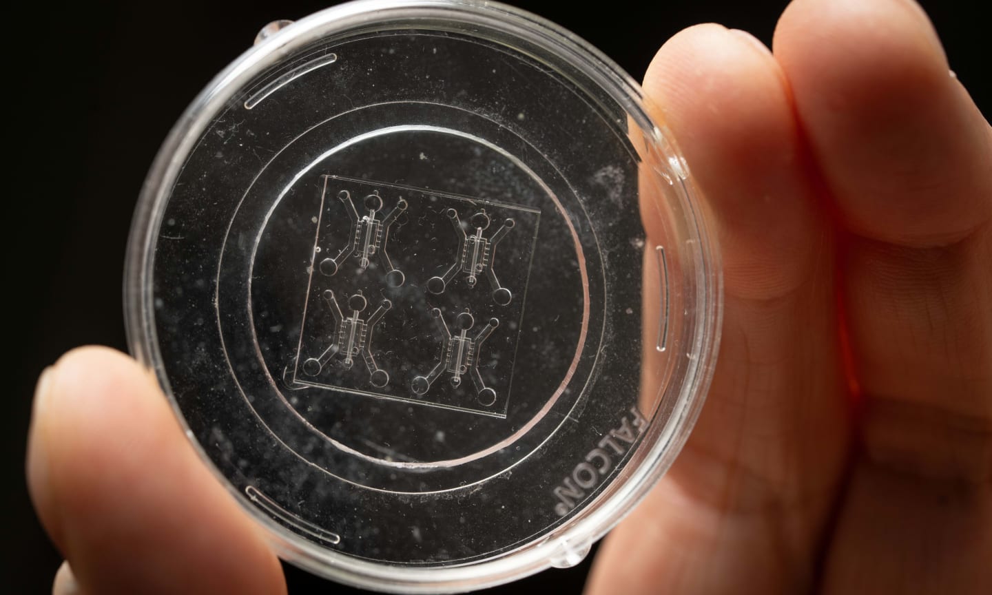 'Tumor on a chip' offers new way to test cancer treatments | UW Health