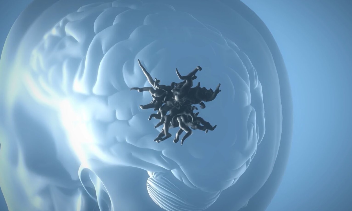 UW clinical trial tests new way to treat glioblastoma | UW Health