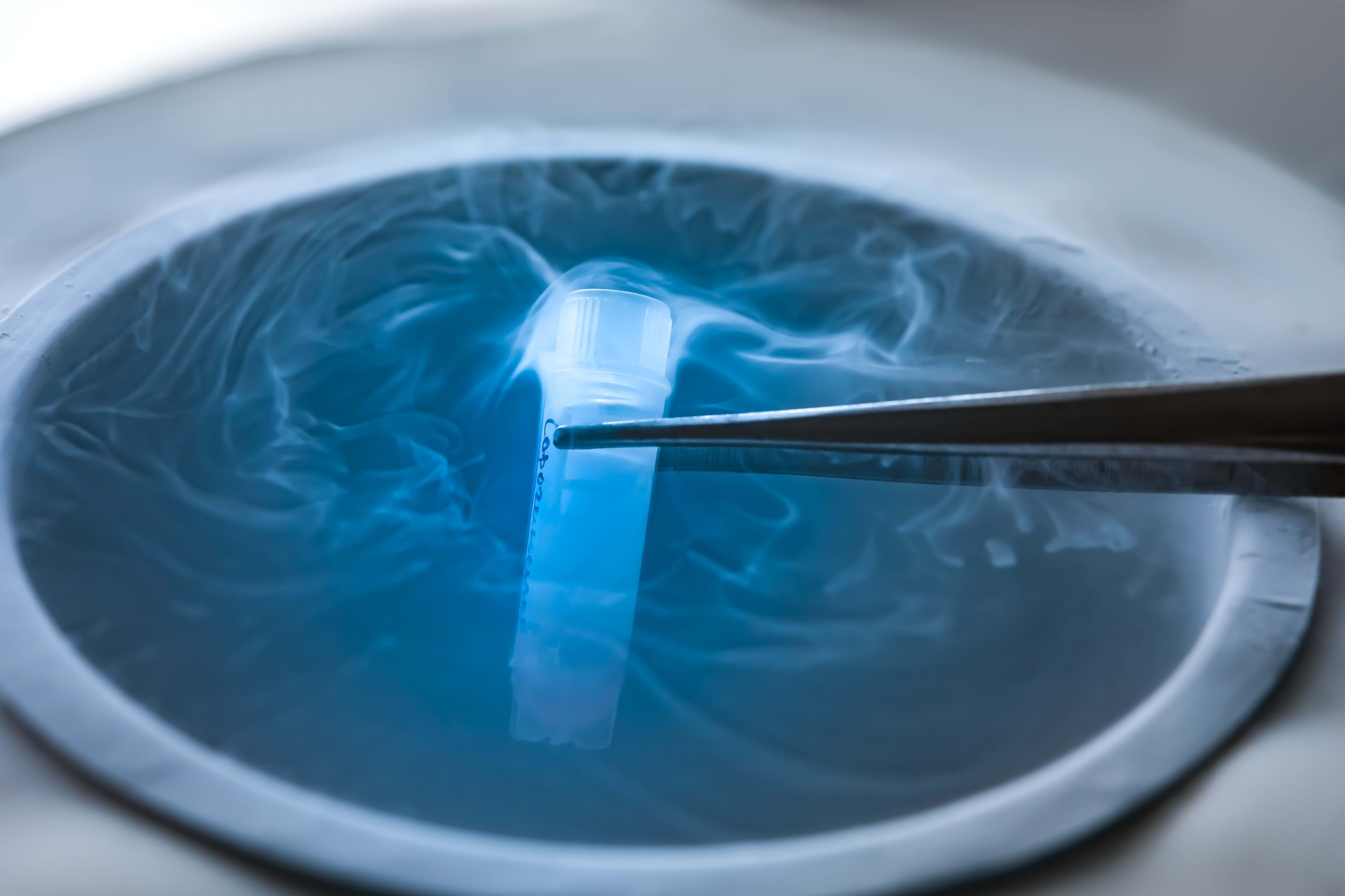 Cryopreservation of Embryos & Sperm | Treatments | UW Health