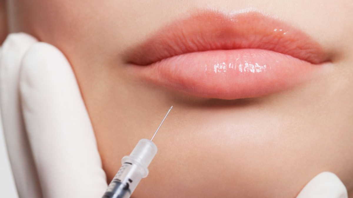 UK: Botox and lip filler injections banned for kids | Health | POST ...