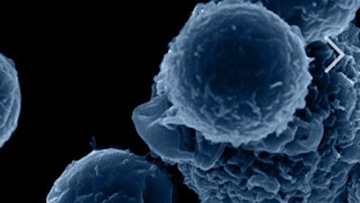 GSK enters agreement to acquire Aiolos Bio for $1.4 billion | Companies ...