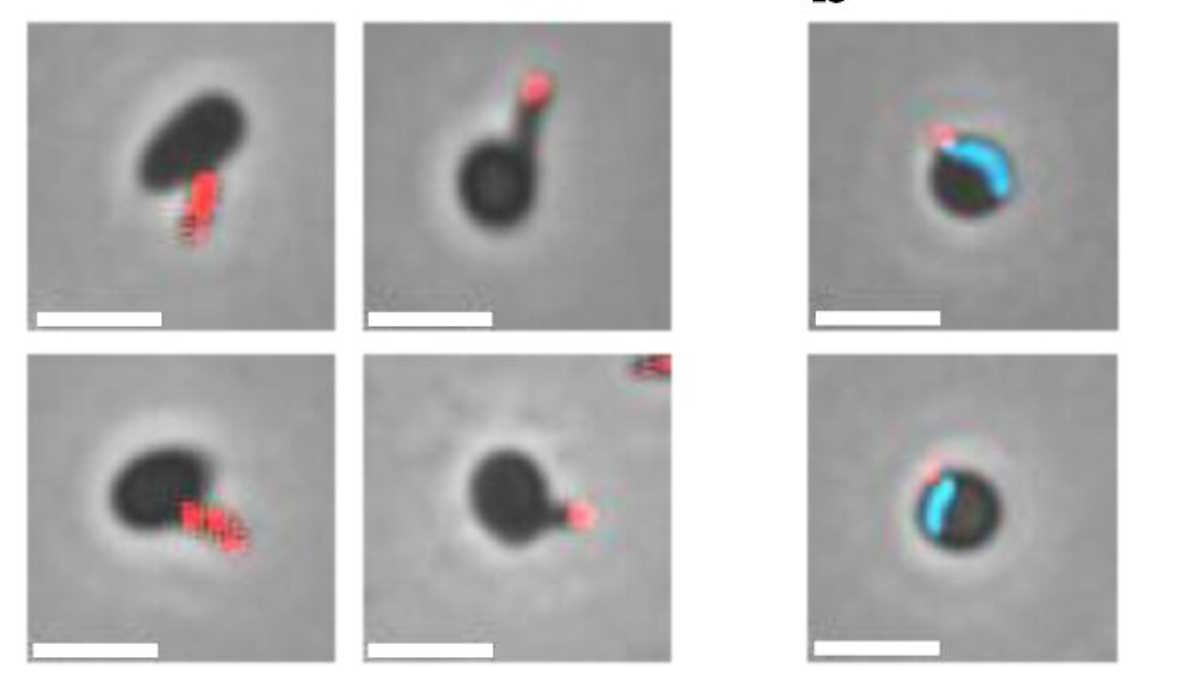 Scientists solve mystery of how predatory bacteria recognizes prey ...