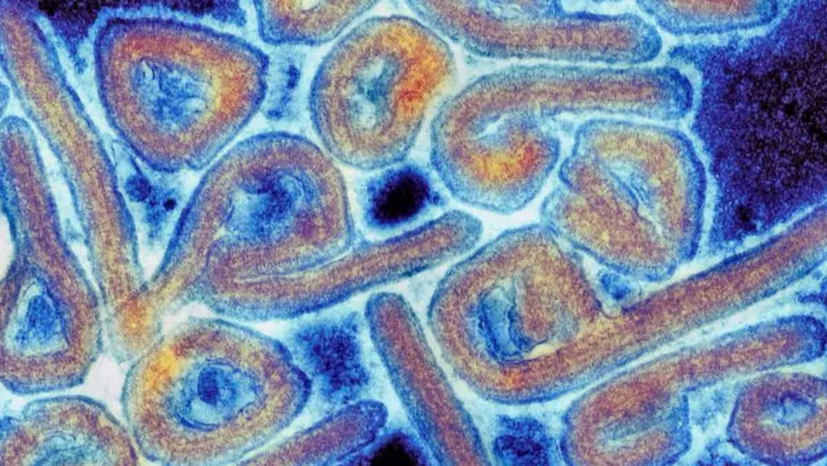 WHO convenes urgent meeting over outbreak of Marburg virus, one of ...