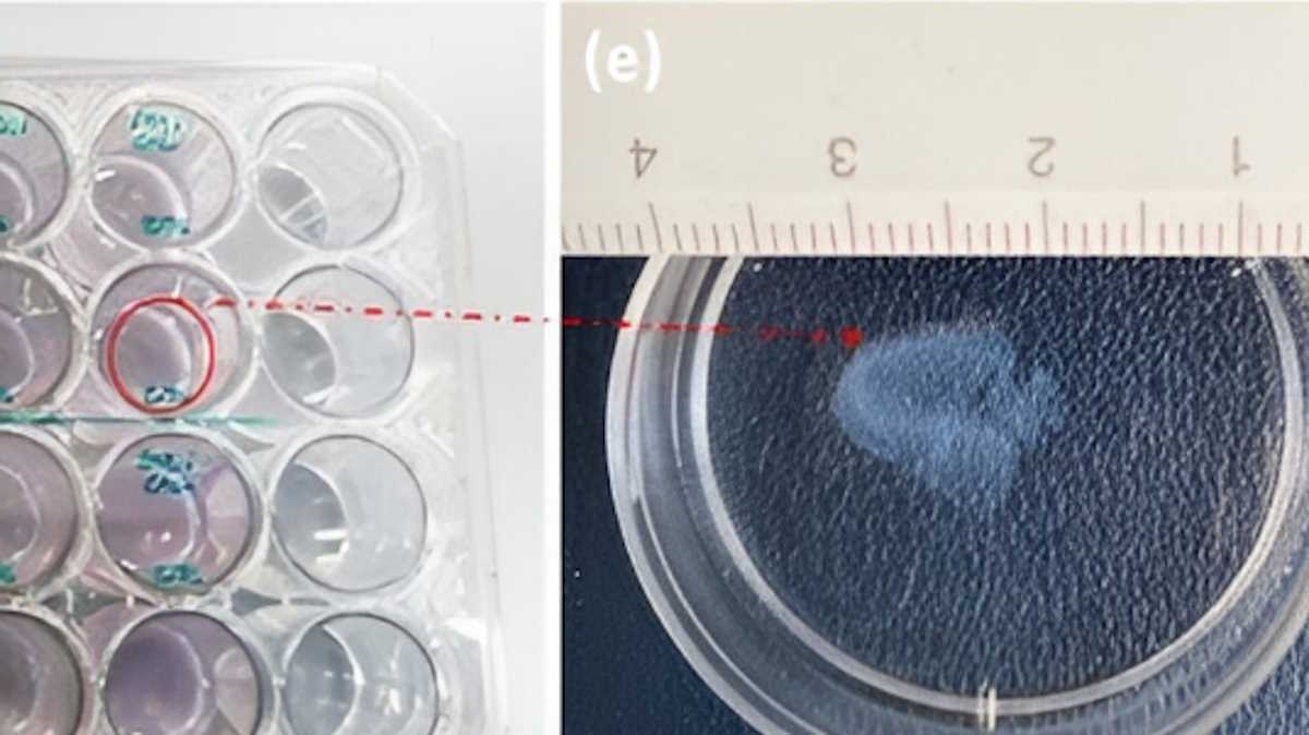Terahertz biosensor detects skin cancer with remarkable accuracy ...