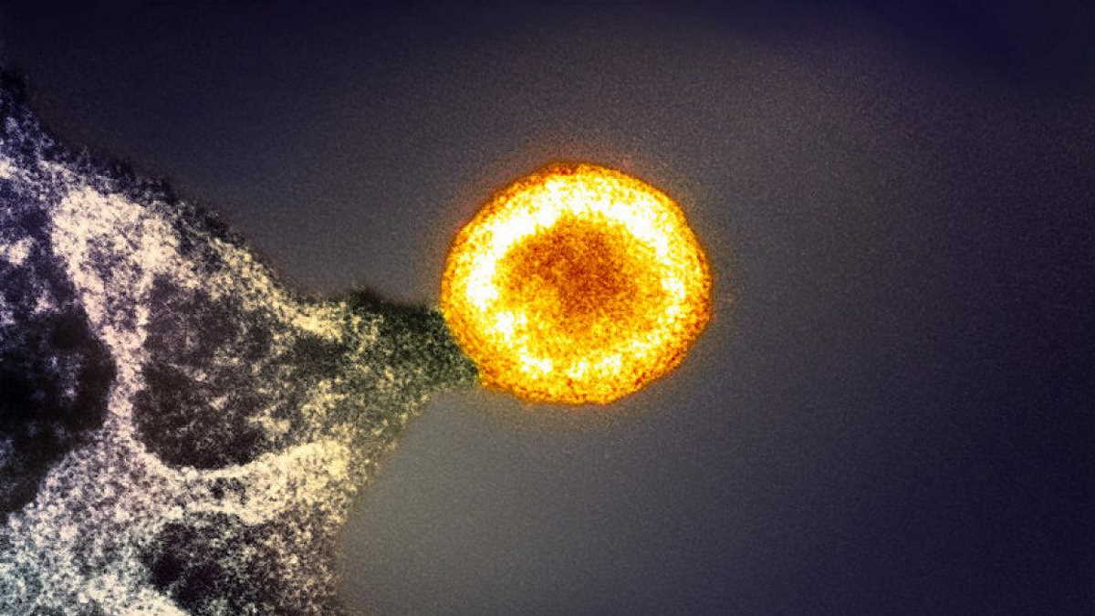 Clinical trial of HIV vaccine begins in U.S. and South Africa | Health ...