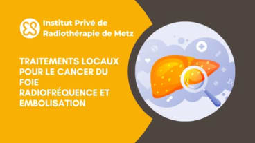 Cancer foie : radiofréquence et embolisation locales