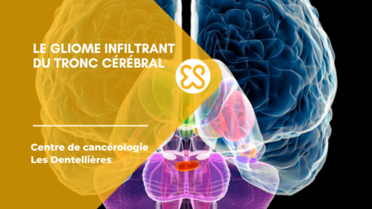 Le gliome infiltrant du tronc cérébral