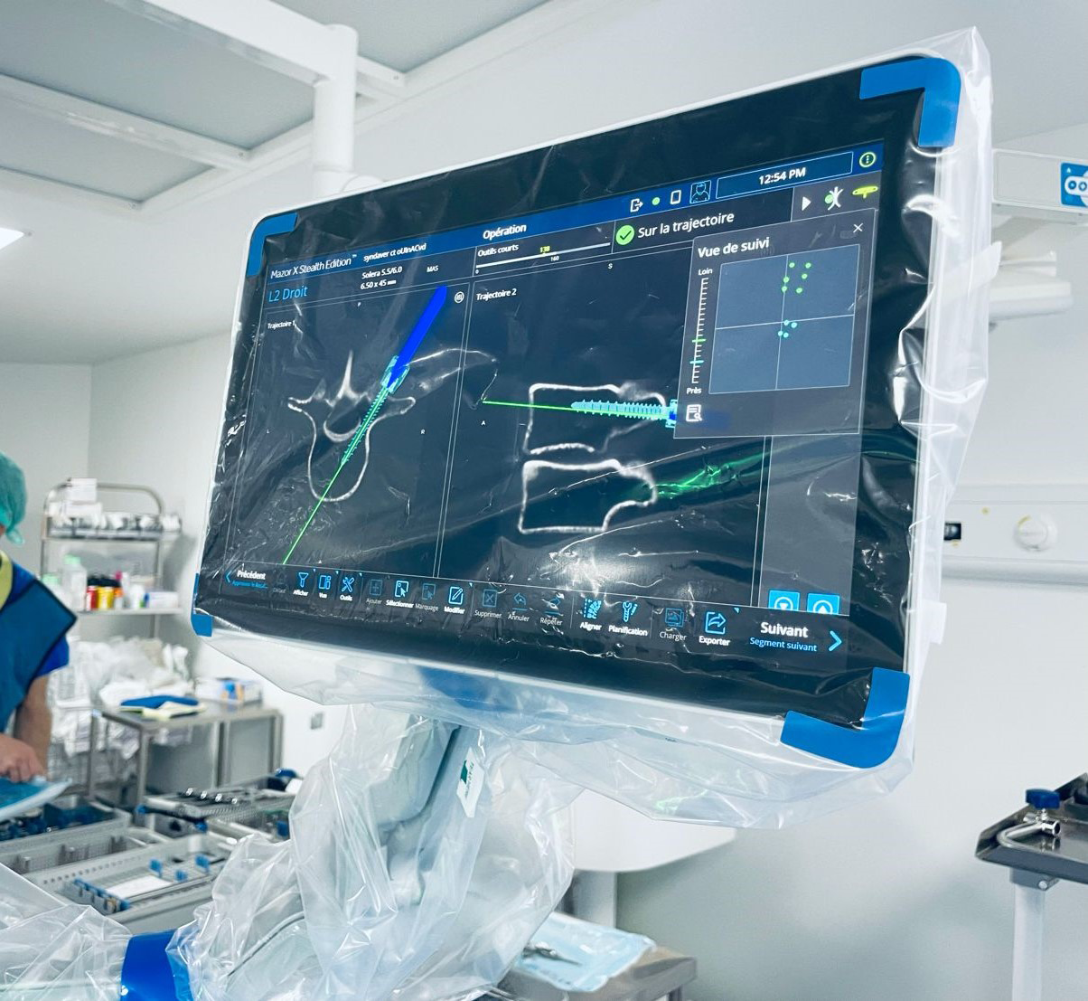 1ers retours d'expérience sur l'utilisation du robot Mazor en chirurgie ...