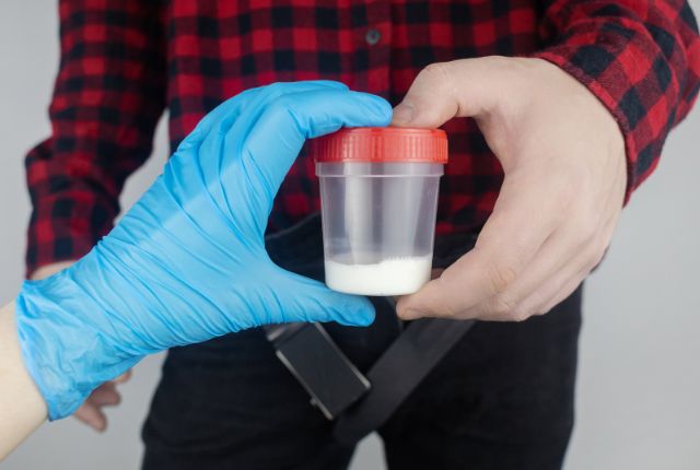 Spermogramme : Bilan de fertilité de l’homme | Elsan