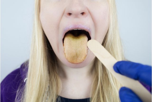 Cholestase : symptômes et traitements | Elsan