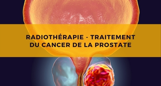 Radiothérapie cancer prostate | Protocole et traitement | Centre ...