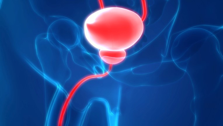 Laser Holep : Une thérapie peu invasive contre l'adénome de la prostate