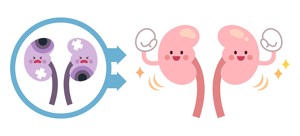 Insuffisance rénale : symptômes, stades et traitements | Elsan