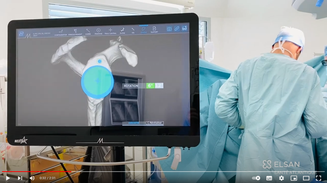 Réalité augmentée et chirurgie de l’épaule à Santé Atlantique | Elsan