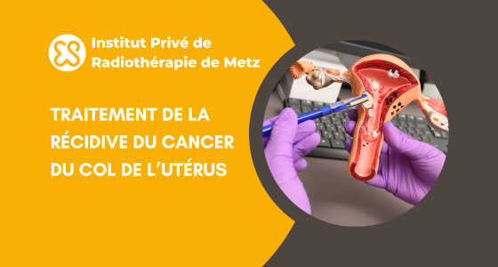 Récidive cancer col utérus : traitements tumeurs du col utérin
