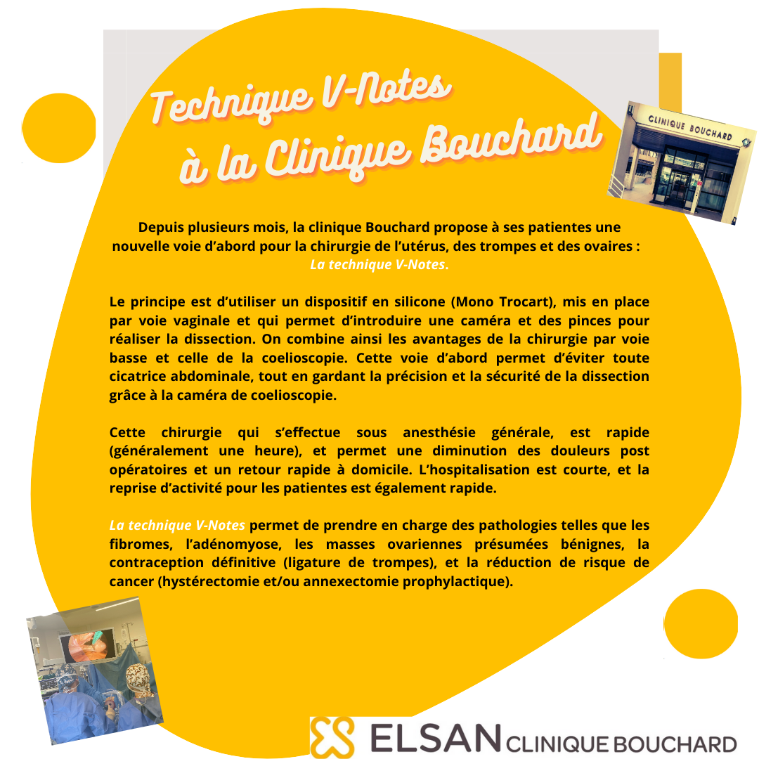 Technique V-Notes | Elsan