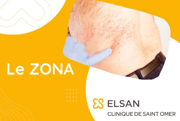 "Le Zona" explication avec le Dr Géraldine Jonniaux | Elsan