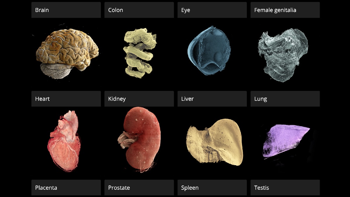 Un «navigateur du corps» pour explorer les organes en 3D
