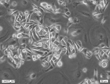 GFP-KSC4 Keratinocyte Stem Cell Line | Cell Lines - Ximbio