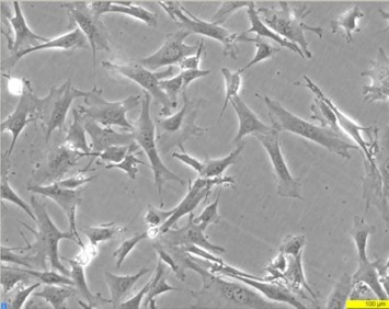 MEF ULK1 KO (SIM) Cell Line | Cell Lines - Ximbio