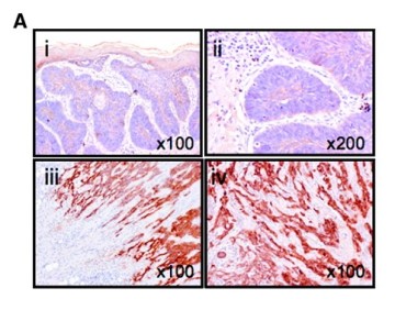 Anti-Integrin aVb6 [AvB6 53a.2] | Monoclonal Antibodies - Ximbio