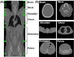 How to interpret CT whole body scans: 3 Essential Methods