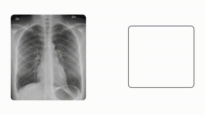 Leveraging AI for X-ray Interpretation: An In-depth Look