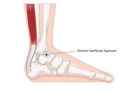 Understanding the Anterior Talofibular Ligament (ATFL)