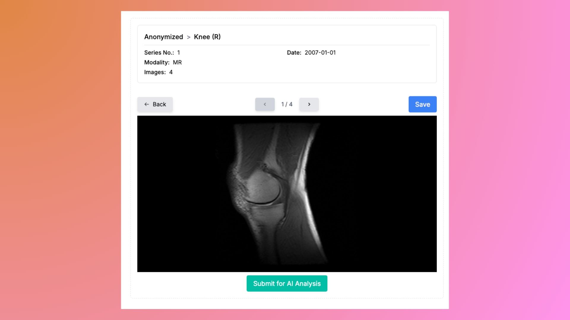 How to Use the Free DICOM Viewer on X-ray Interpreter