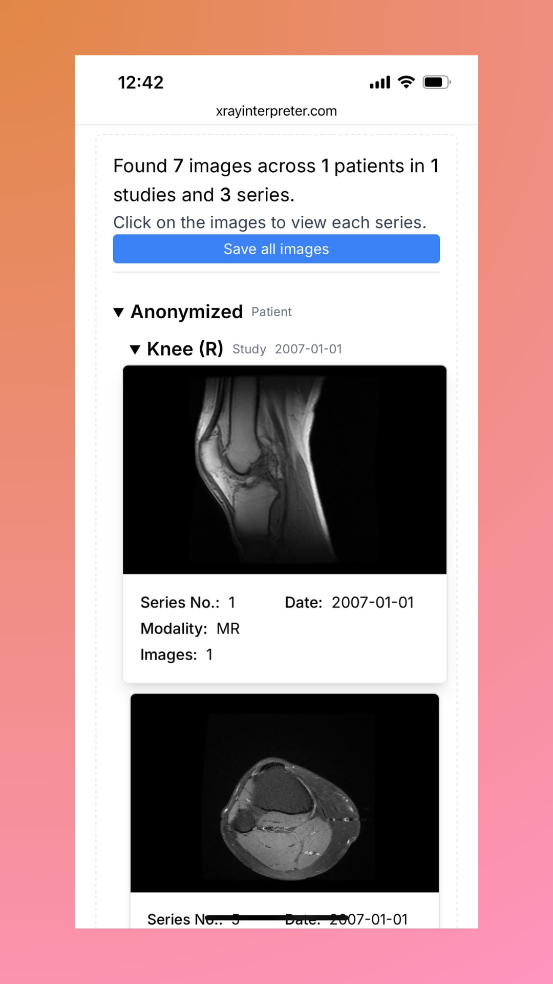 Как открыть файл DCM на Android