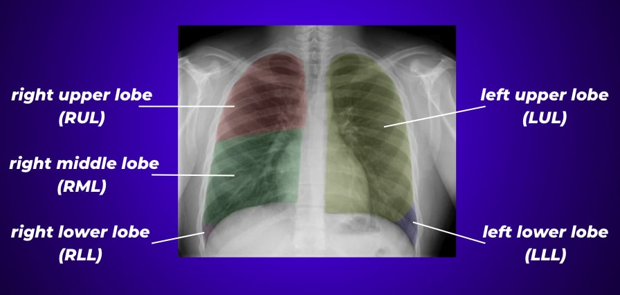 正常な胸部X線と異常な胸部X線: それは何を示していますか？