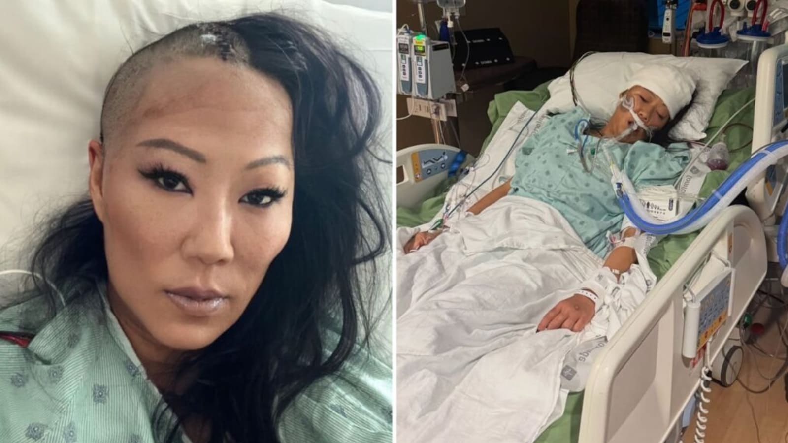 ‘Bling Empire’ Star Lynn Ban Undergoes Emergency Brain Surgery After ...