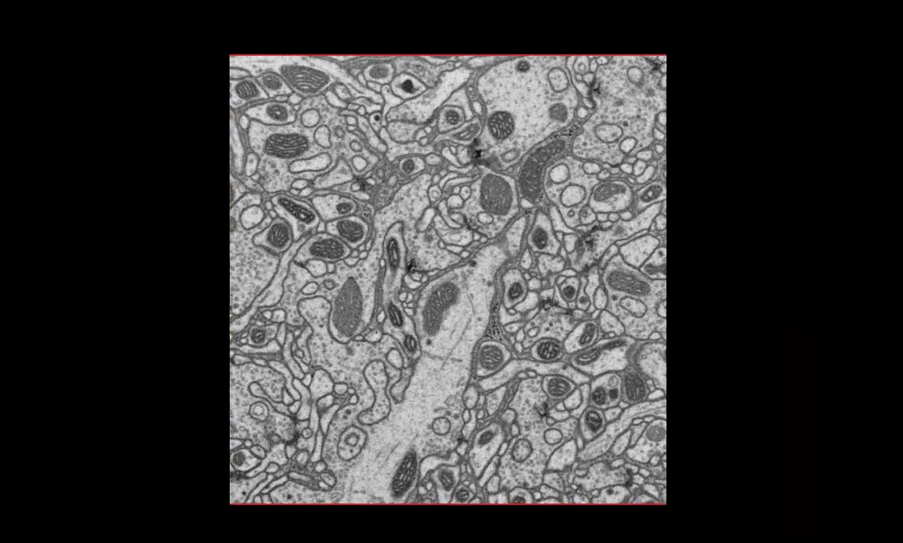 200x larger FIB-SEM volume at 4-nm voxels