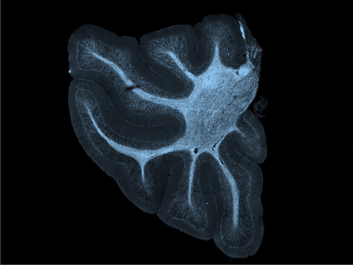 The Most Popular Neuroscience Stories of 2023