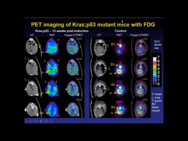 Novel PET Imaging in Oncology