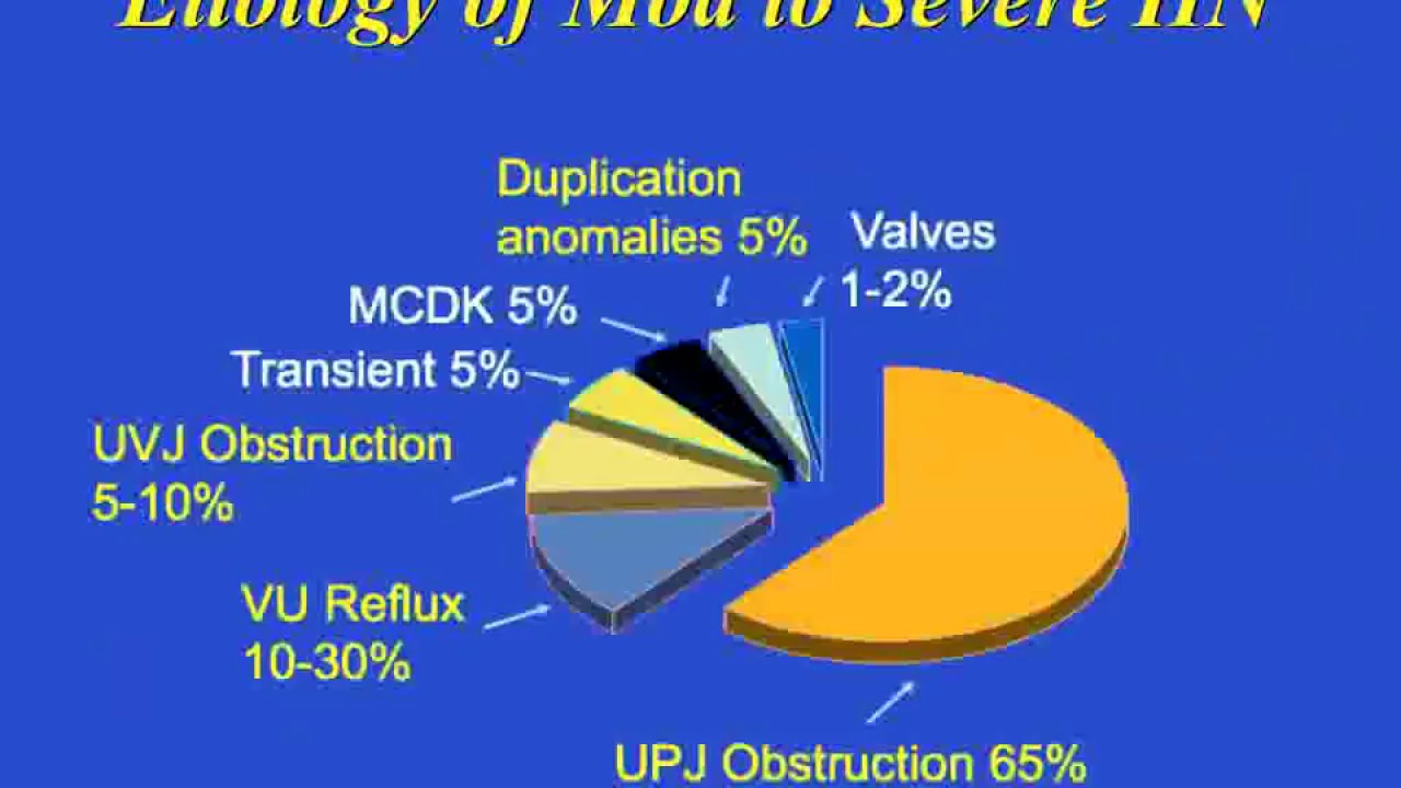 Magnetic Resonance Urography in Congenital Urological Disorders