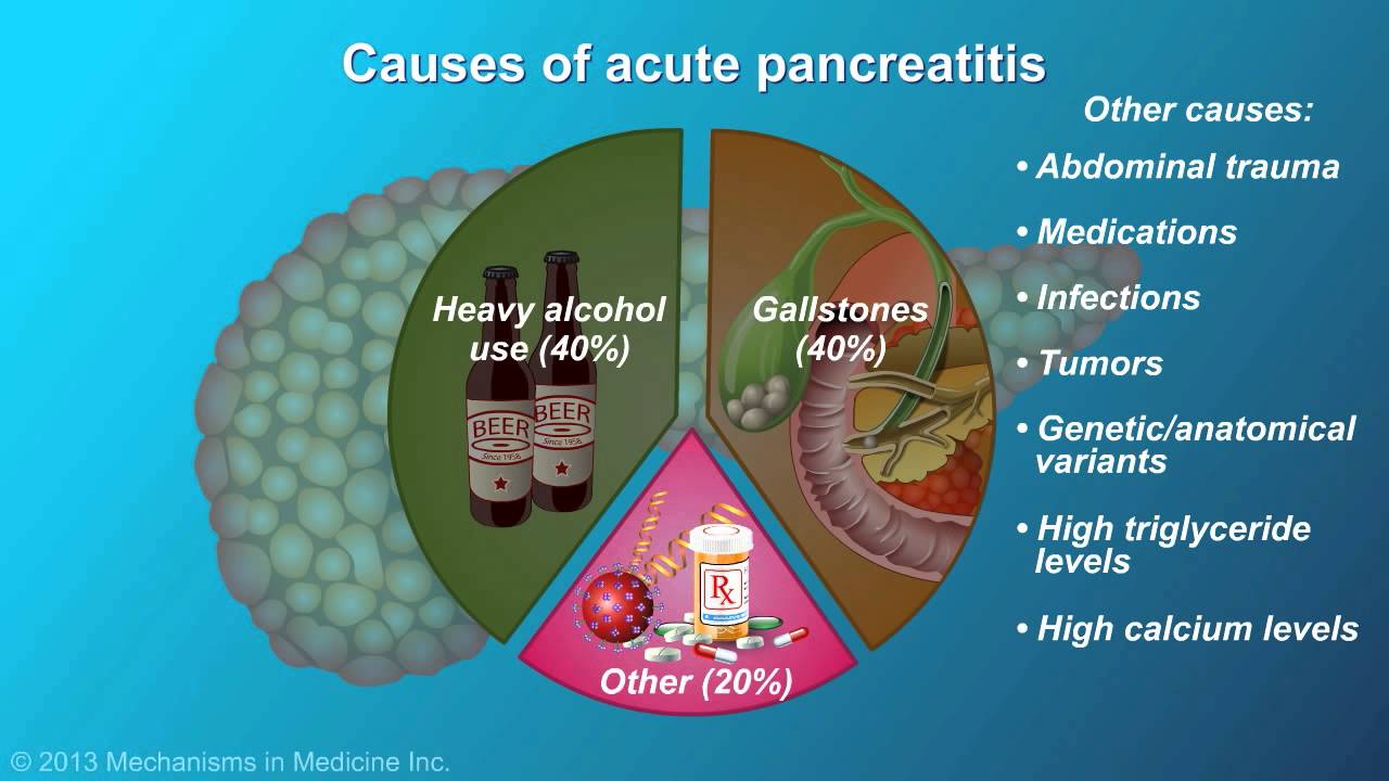 Animation - Acute Pancreatitis
